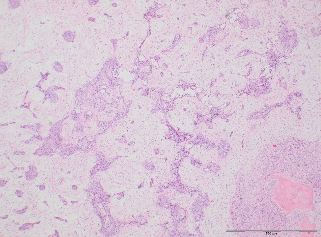 #msk #musculoskeletal #Radiology #MSK #orthopedics #orthotwitter Here a ...