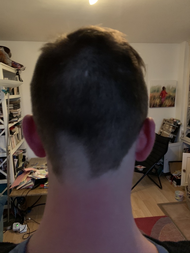 Cowlick Back Of Neck
