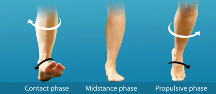 Tibial Internal Rotation