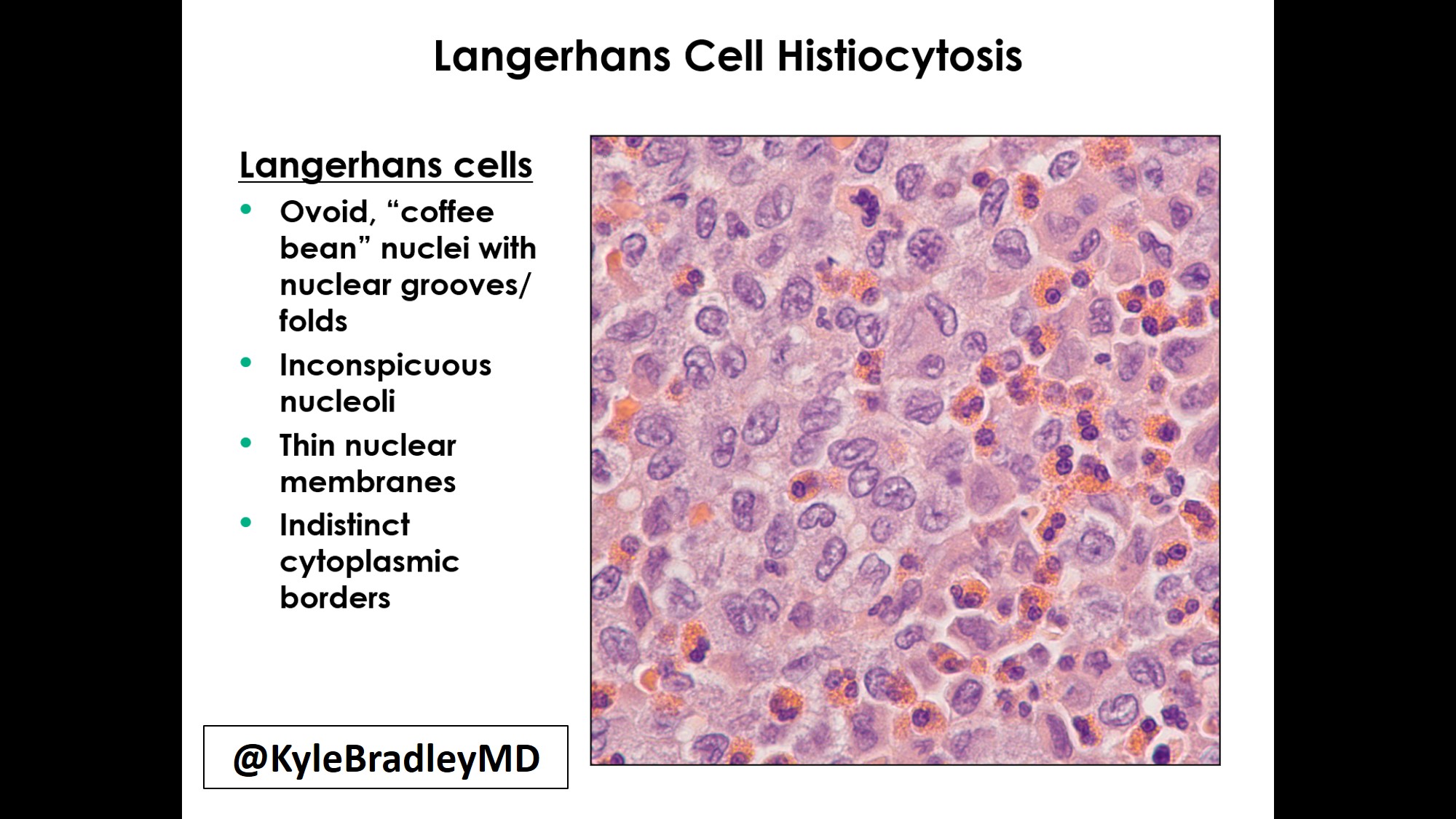 Langerhans Cells Histology Hot Sex Picture