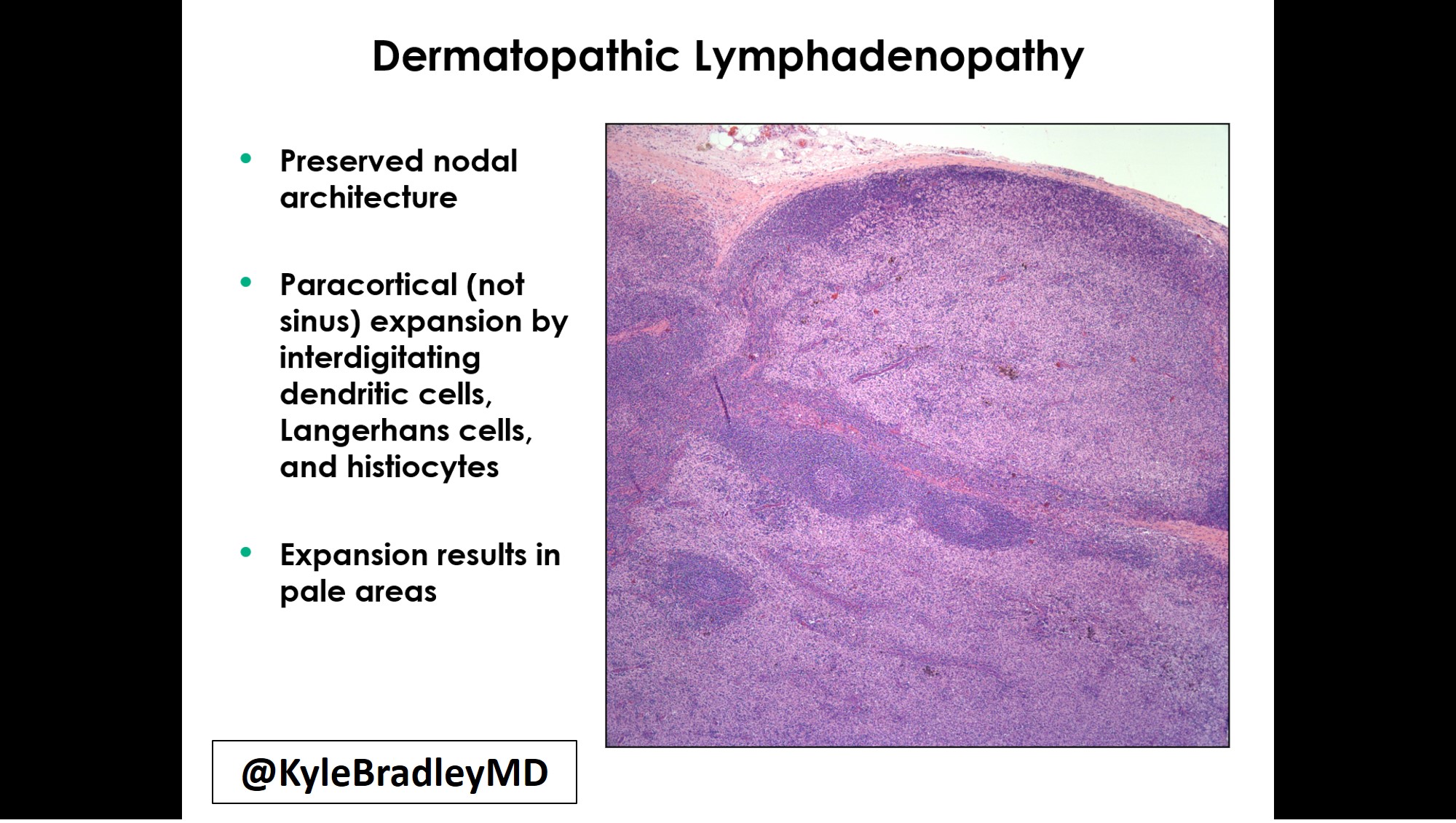 Lymph Node Histology Paracortex
