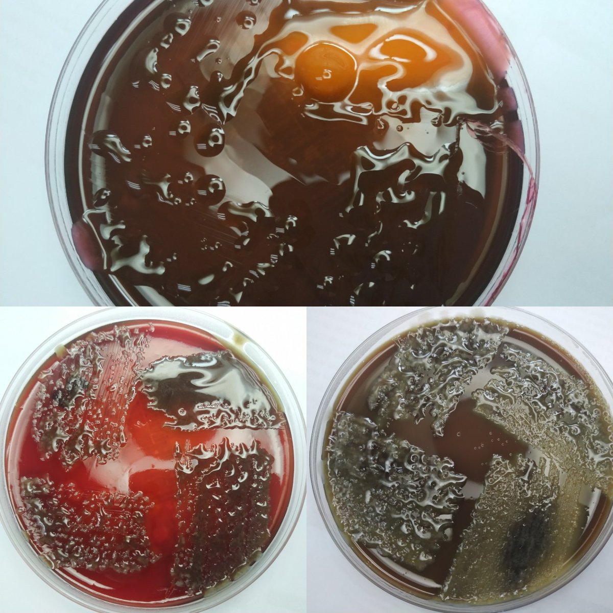 Pseudomonas Aeruginosa Emb