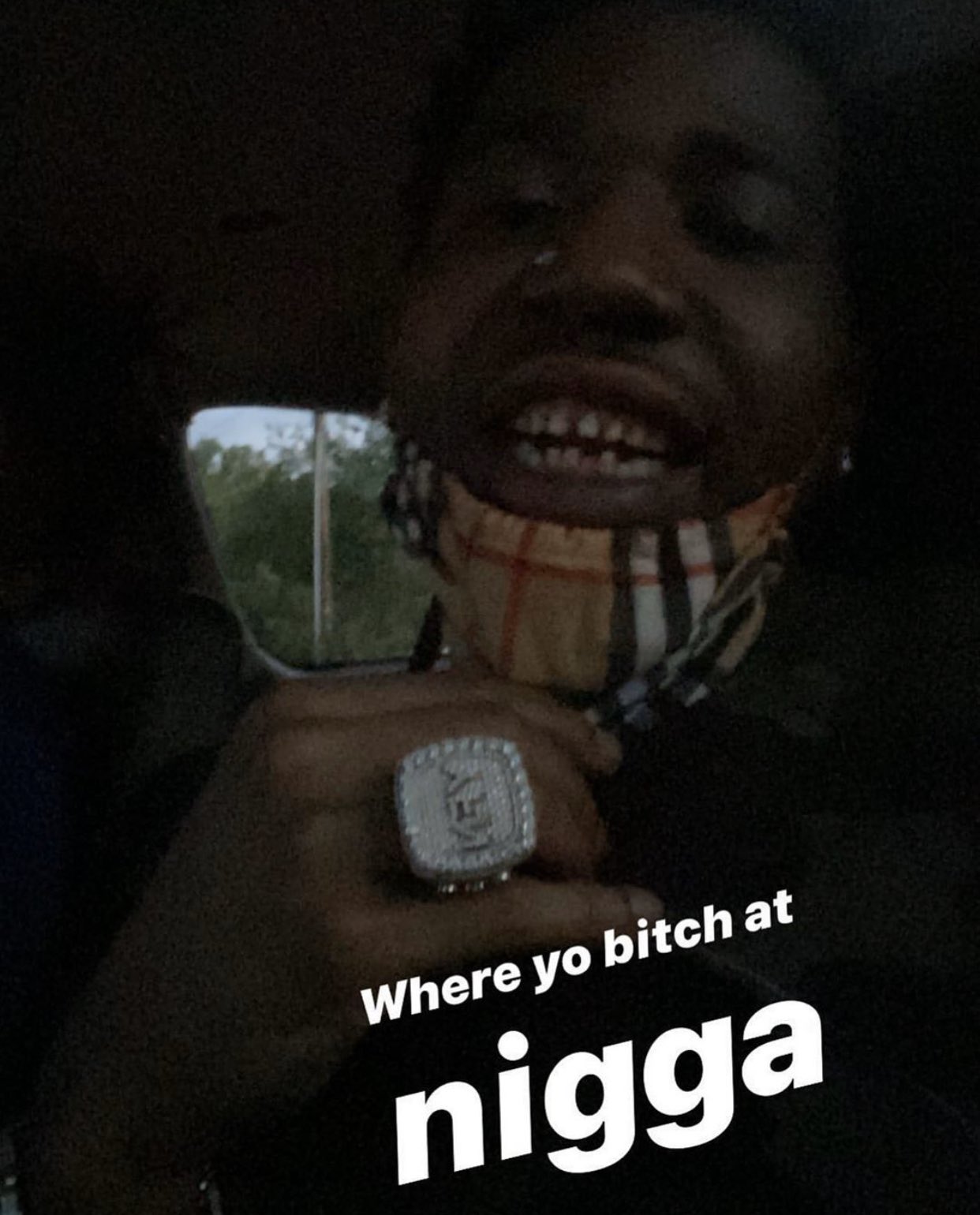 Yfn lucci teeth store
