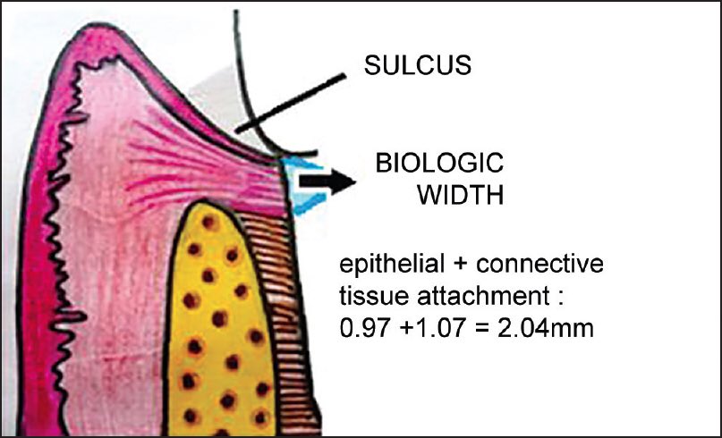 Gingival Sulcus Depth