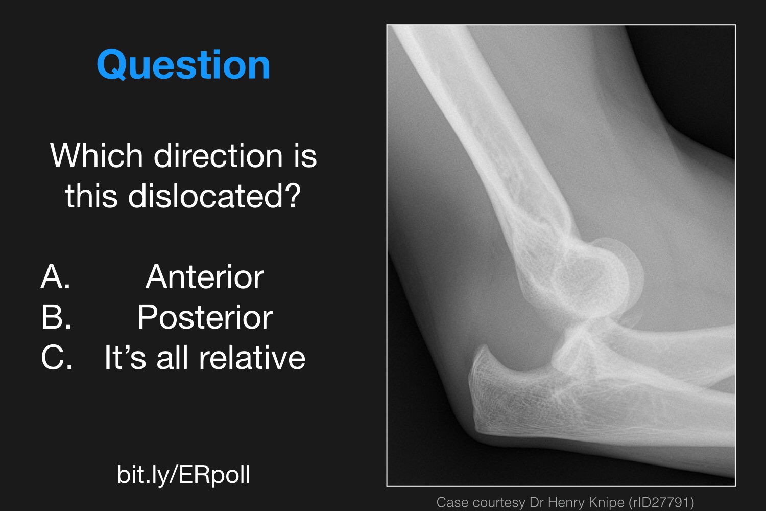 Radiopaedia Quiz Quiz Of The Month September 2024 Learning Modules