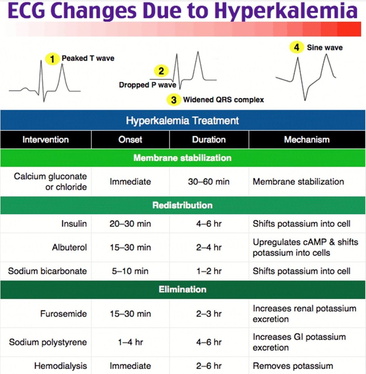 Sine Wave Hyperkalemia Ecg Changes