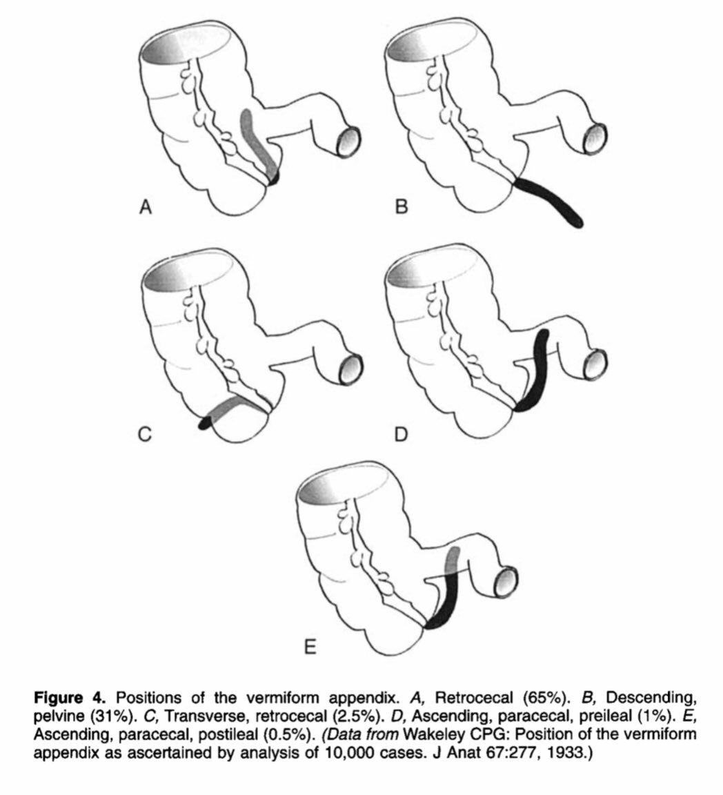Vermiform Appendix