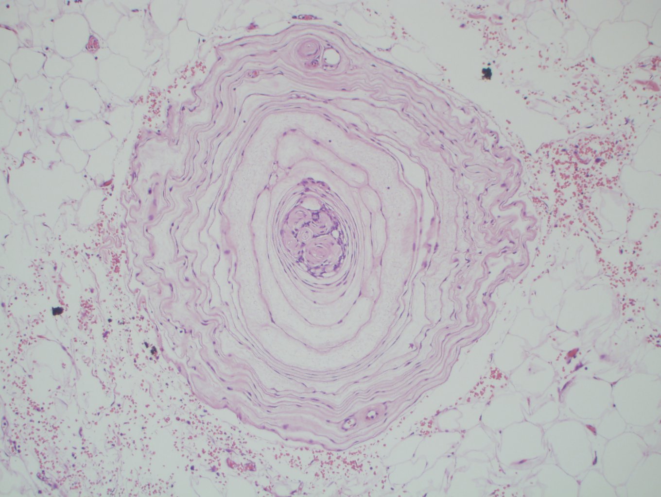 Pacinian Corpuscle Slide