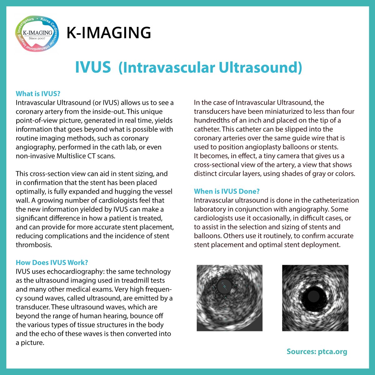 K Imaging On Twitter Ivus Intravascular Ultrasound First