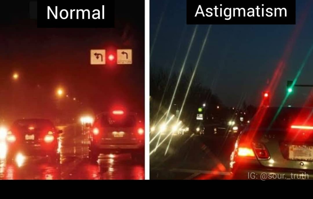 Astigmatism Example At Night