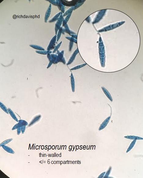 Microsporum Gypseum