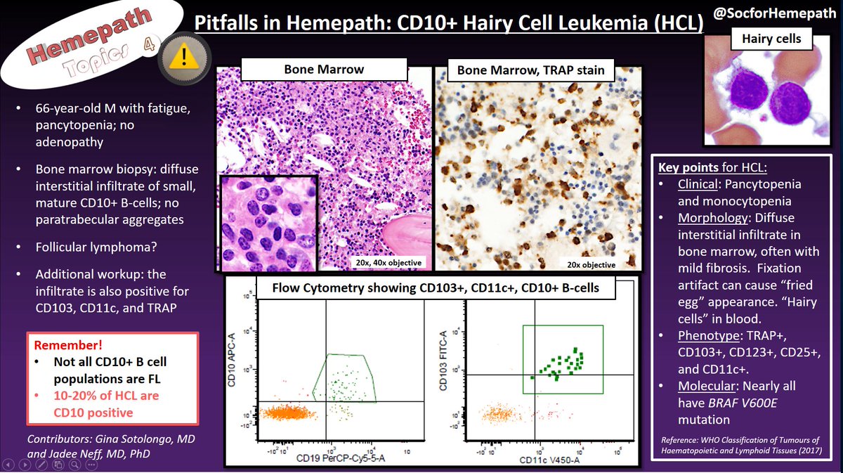 Hairy Cell Leukemia Trap