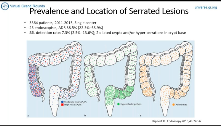 @AmCollegeGastro Virtual Grand Rounds - Serrated Polyps and SPS🔑 Pts: 🪚 ...