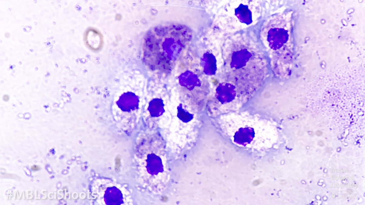 Horseshoe Crab Blood Cells