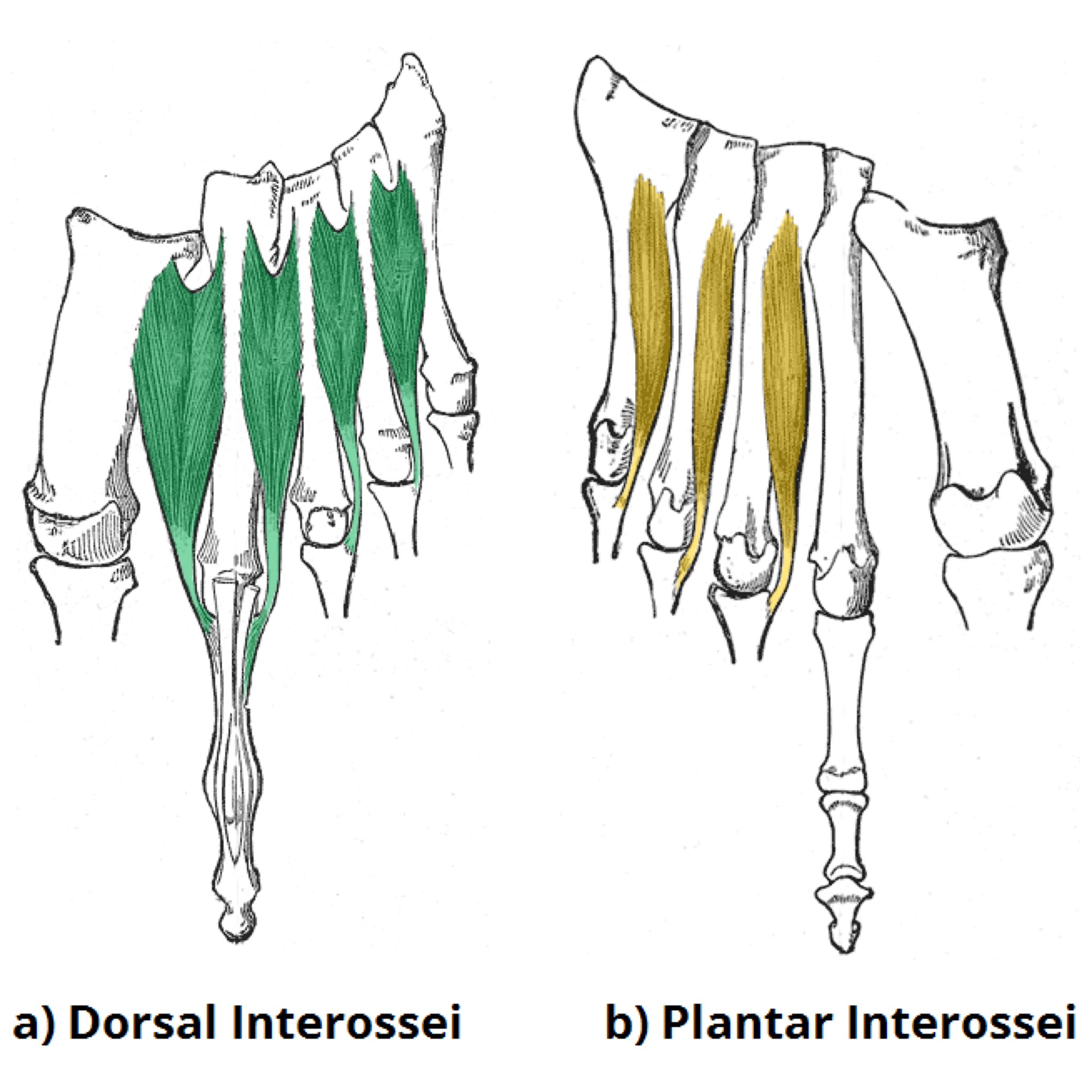 Plantaris Muscle Cadaver