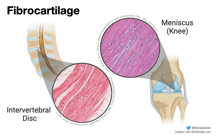 Fibrocartilage 40x