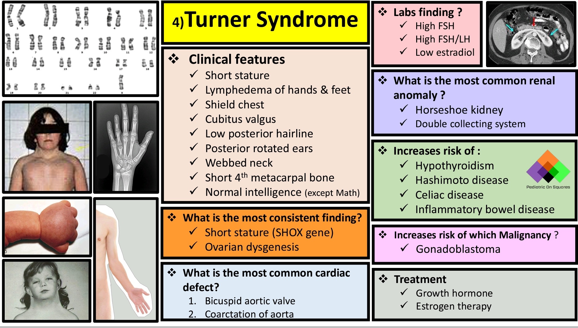 Xo Syndrome Triple X Syndrome Genetic Condition Three Stock