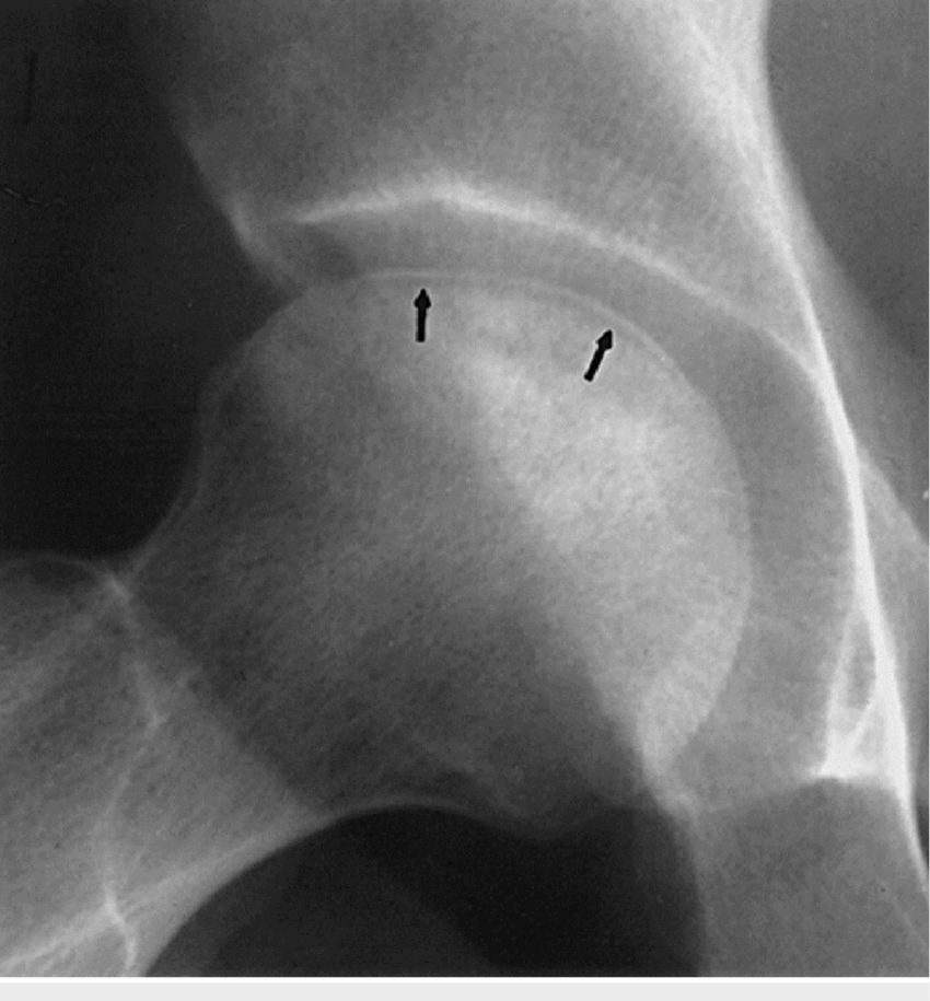 Miguel Vazquez Gomez On Twitter Signo De La Media Luna Crescent Sign ...