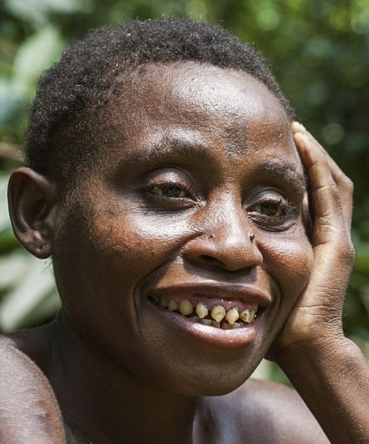 Pygmy People Teeth