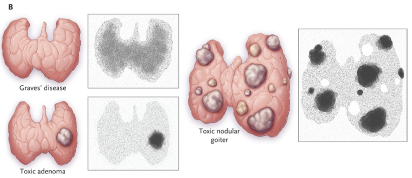 Handout from our second Endocrinology episode "Episode 32 ...