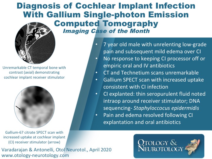 Diagnosis And Corresponding Gallium Scan