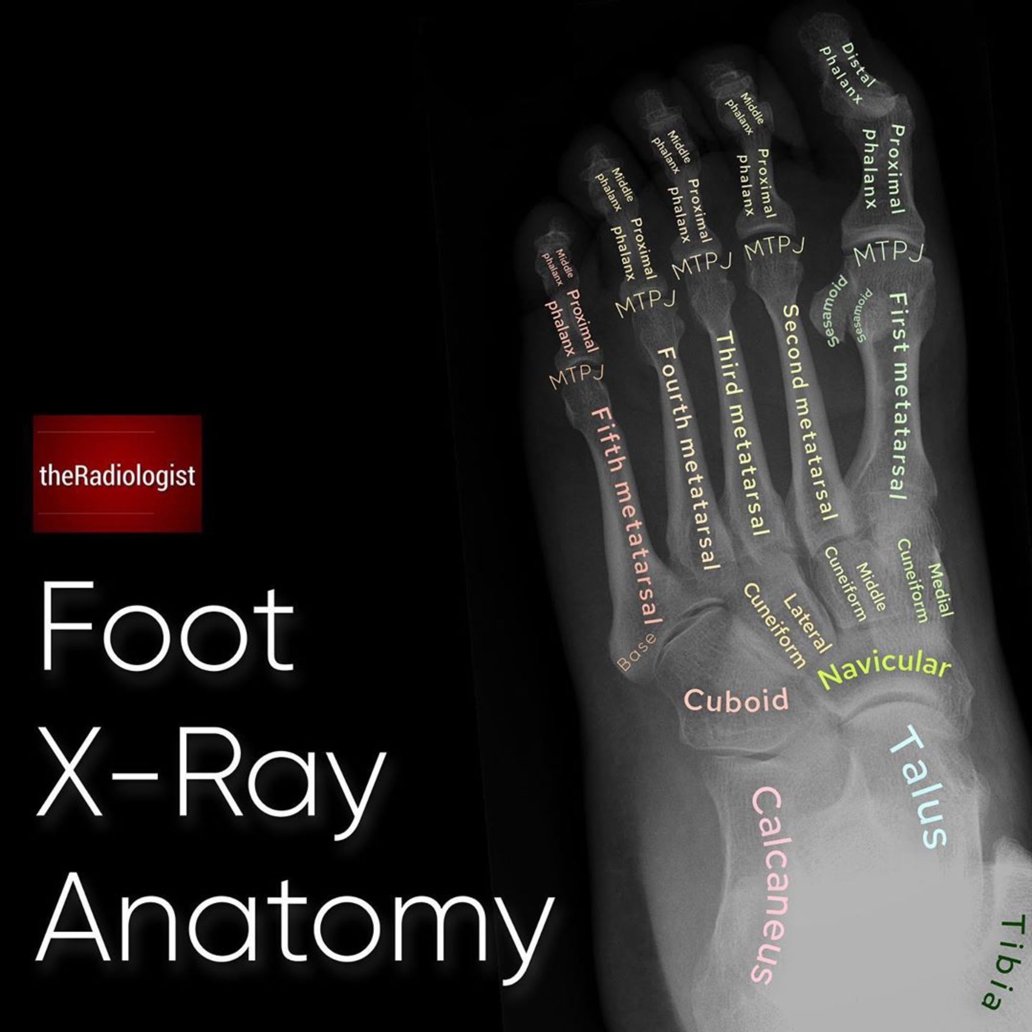 Foot X Ray Normal