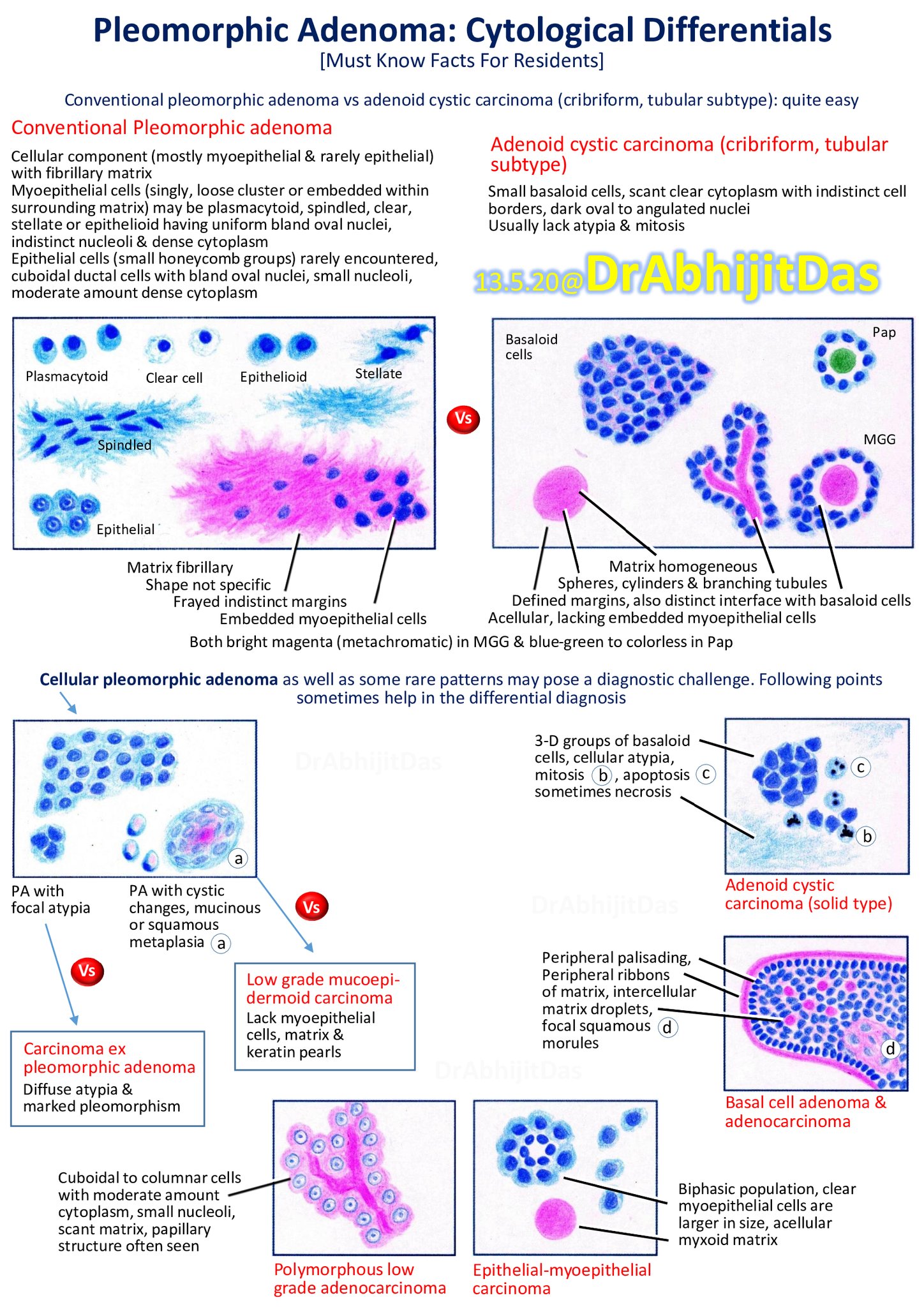 Pleomorphic Adenoma Cytology