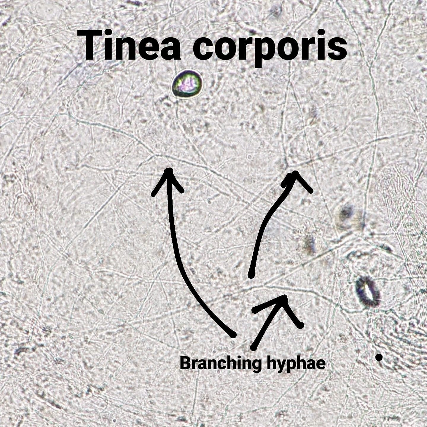 Tinea Microscope