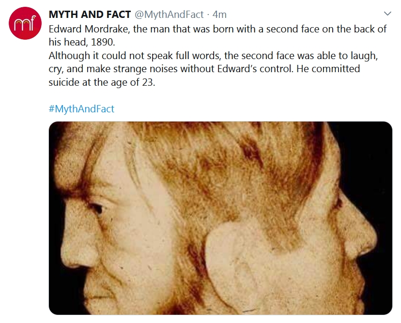 Edward Mordrake The Man With An Extra Face