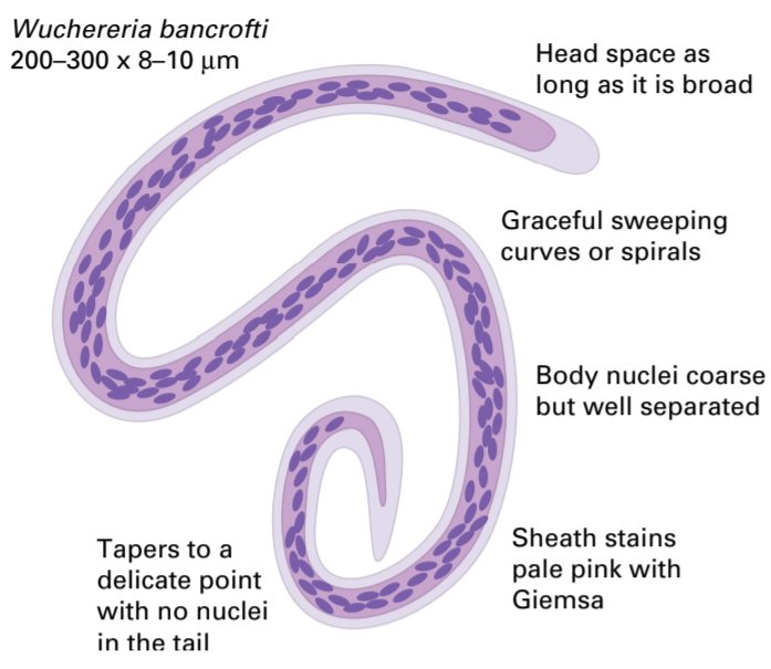 Wuchereria Bancrofti Diagram