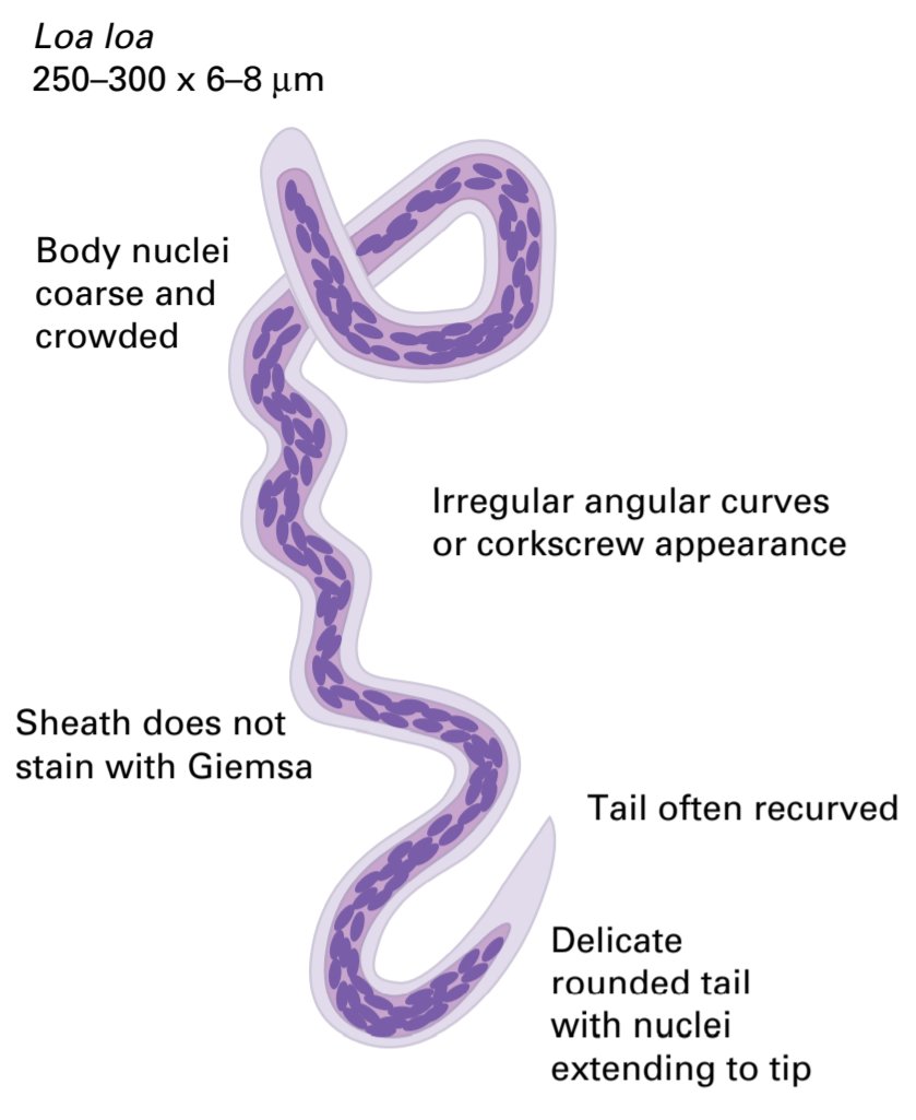 Loa Loa Microfilarie
