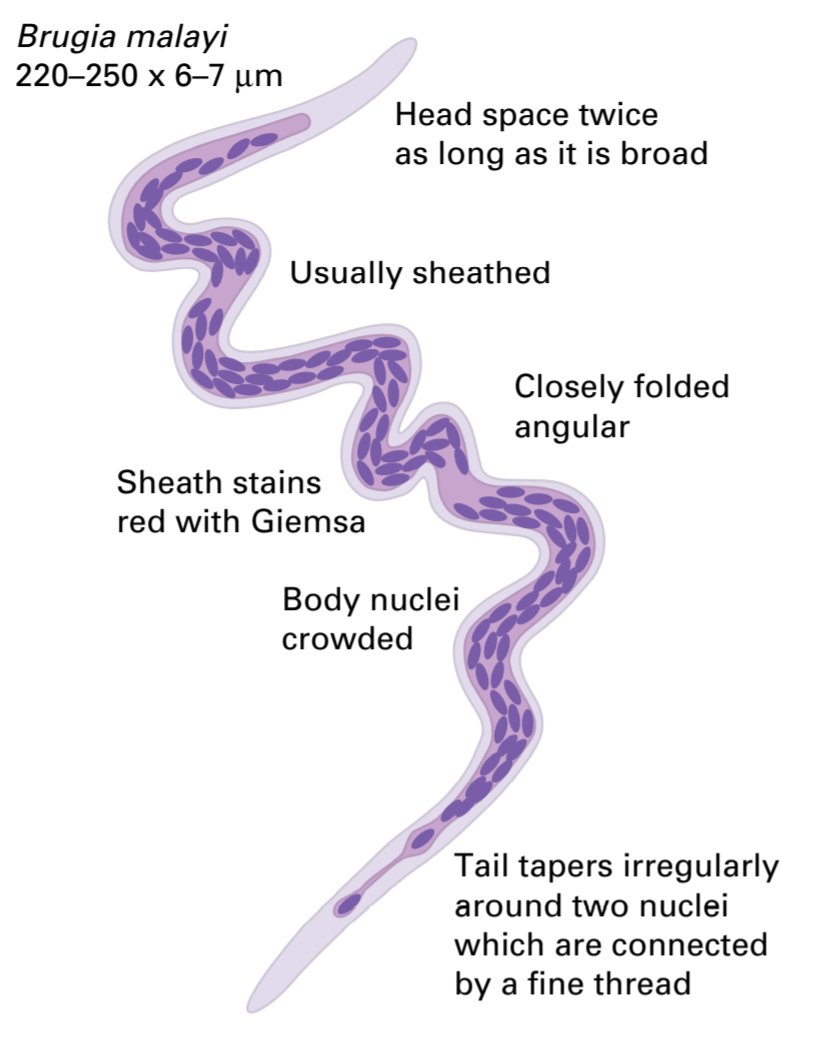 Wuchereria Bancrofti Microfilaria