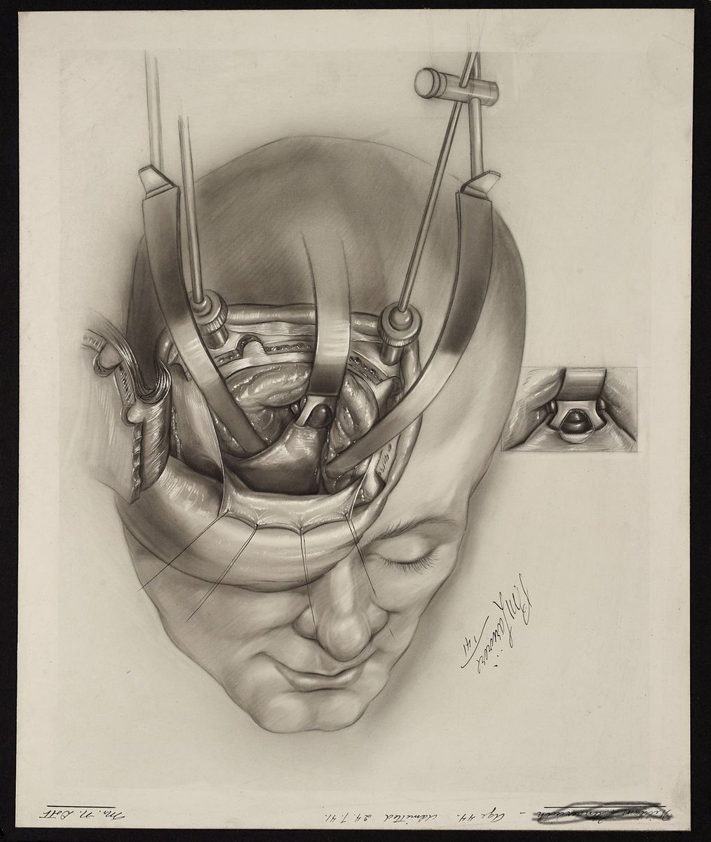 Harvey Cushing Drawing