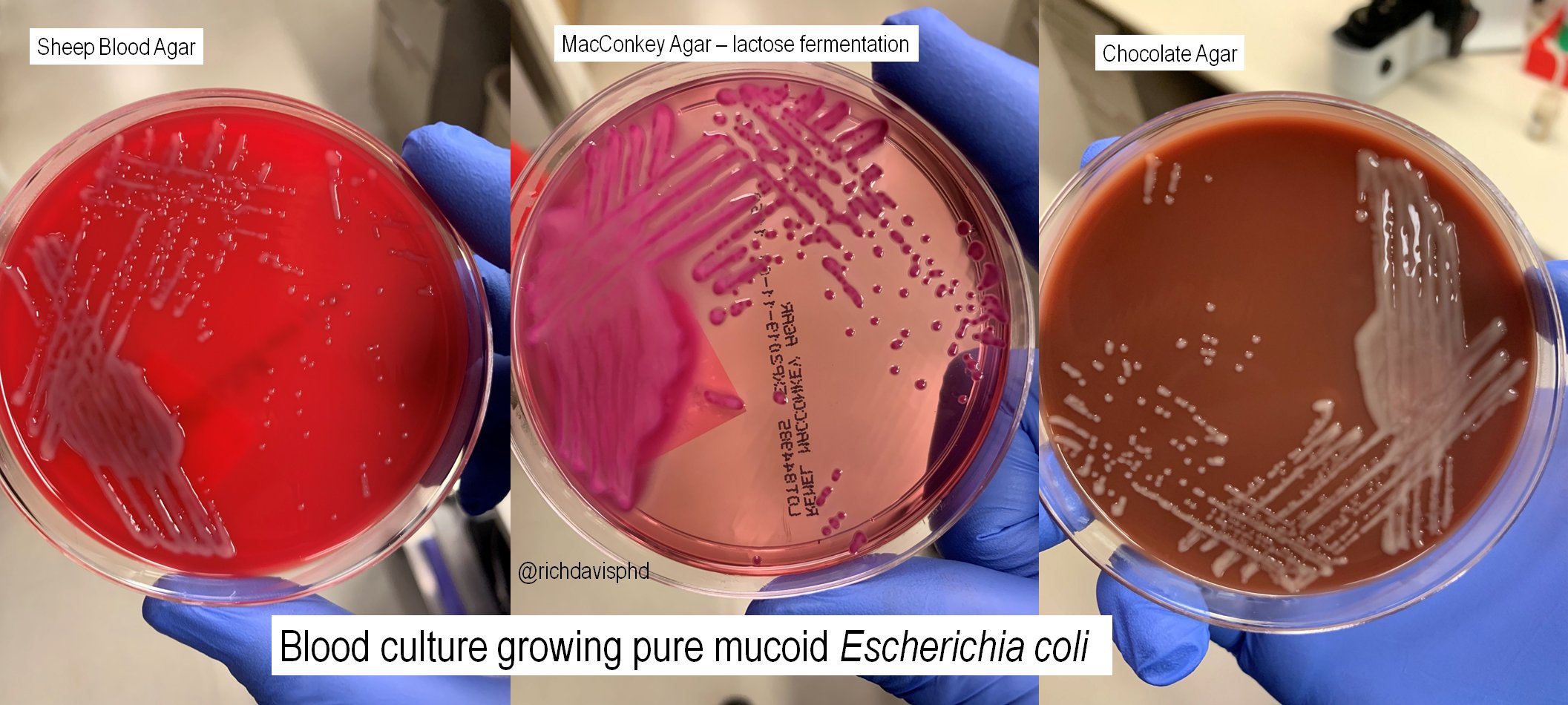 E Coli On Blood Agar