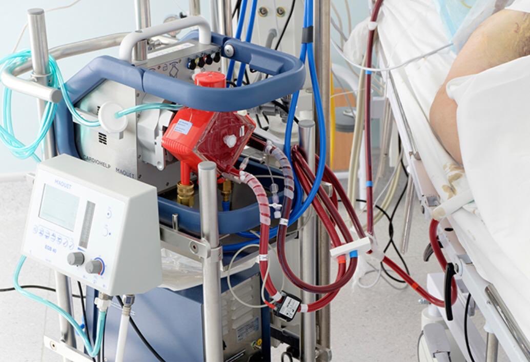 In this thread, we will talk about: Extracorporeal membrane oxygenation ...