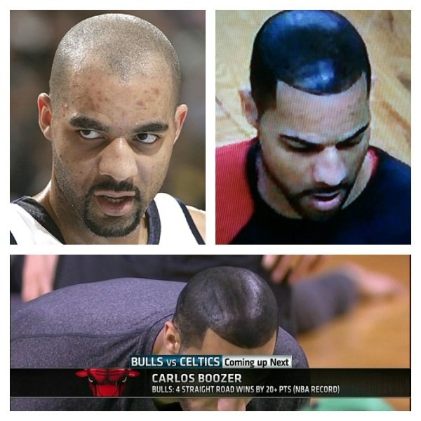 Drew Gooden Hair Patch