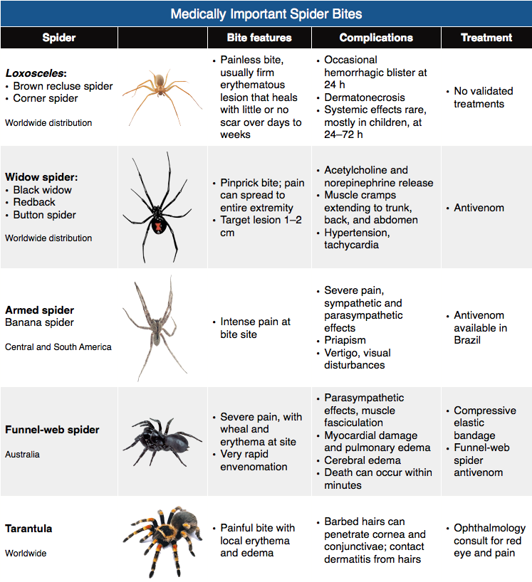 Arachnid Diagram Spider Coloring And Drawing Book For Kids Ages 3 8: