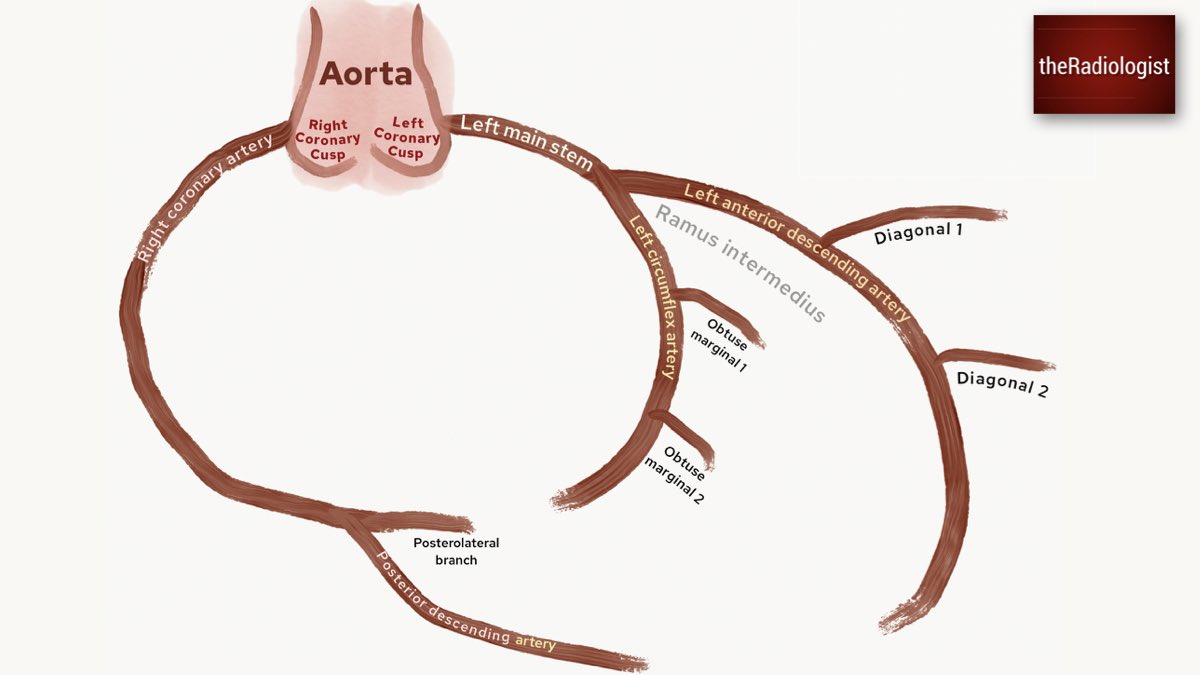Thread by @radiologistpage: Coronary artery anatomy on CT - open thread ...