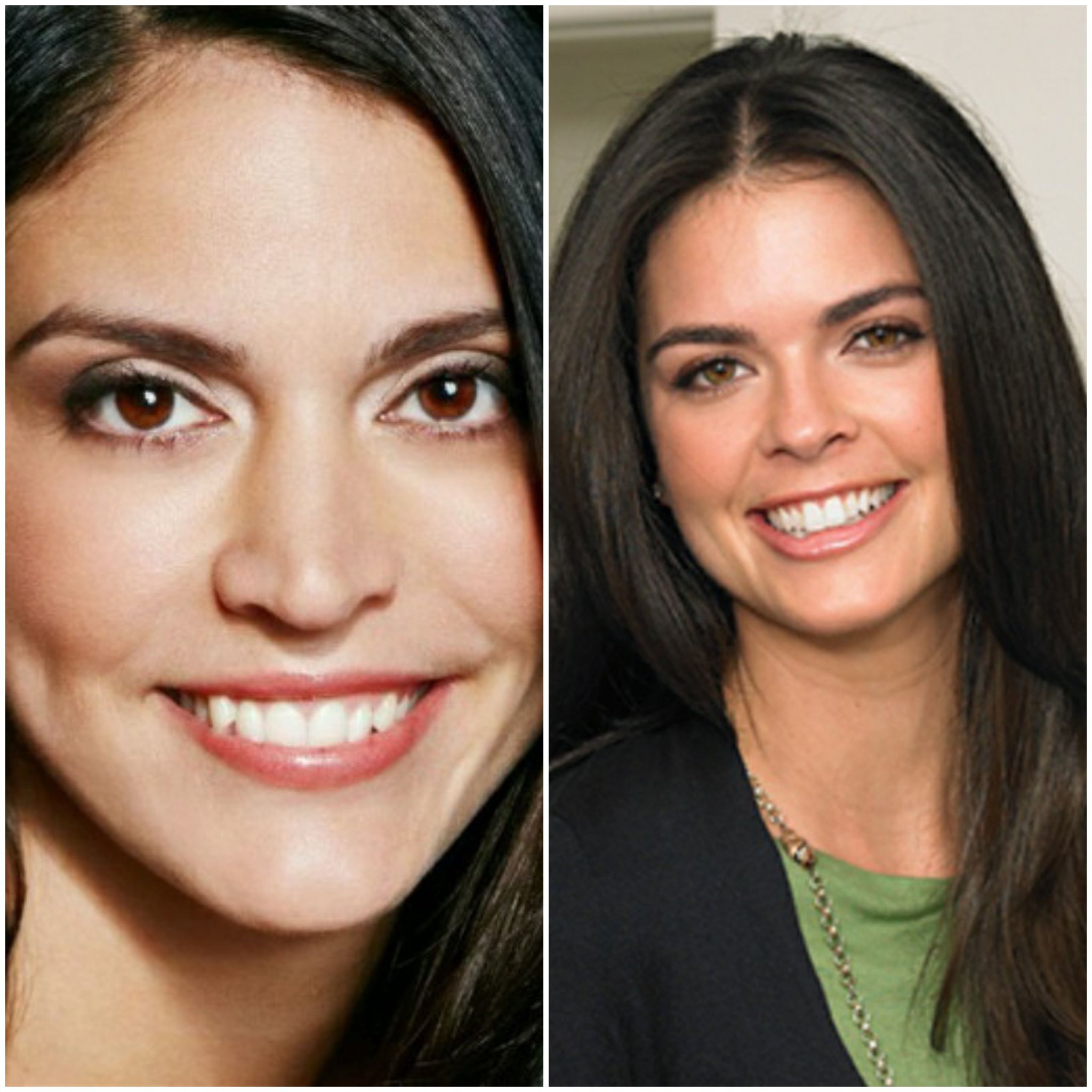 Cecily Strong Before And After