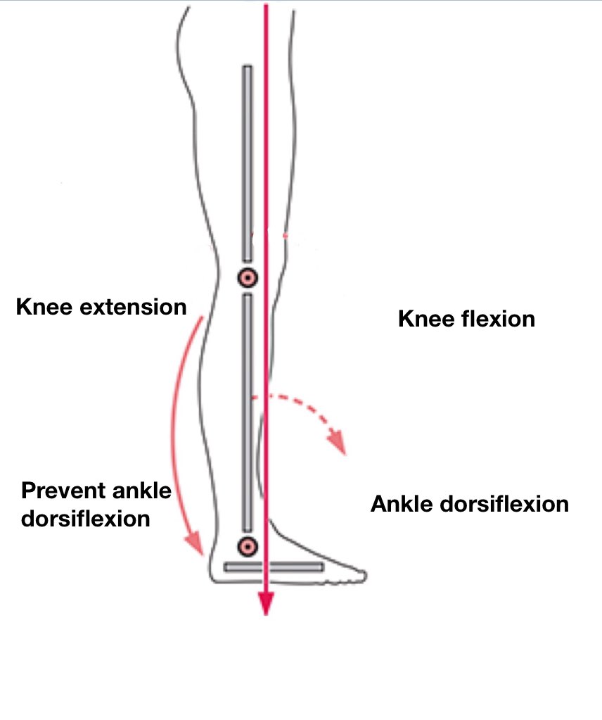 أسعد الله أوقاتكم بكل خير 👋🏻 تعتبر الـ Gait patterns أحد أهم المشاكل ...
