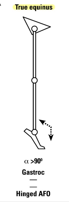 أسعد الله أوقاتكم بكل خير 👋🏻 تعتبر الـ Gait patterns أحد أهم المشاكل ...