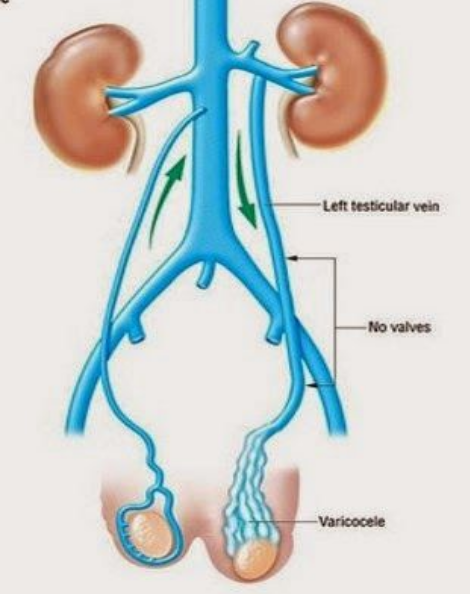 Gonadal Vein Anatomy