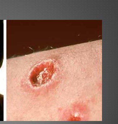 🛑Leishmania - Thread from Spc.Laboratory🫀 @LaboratorySpc - Rattibha