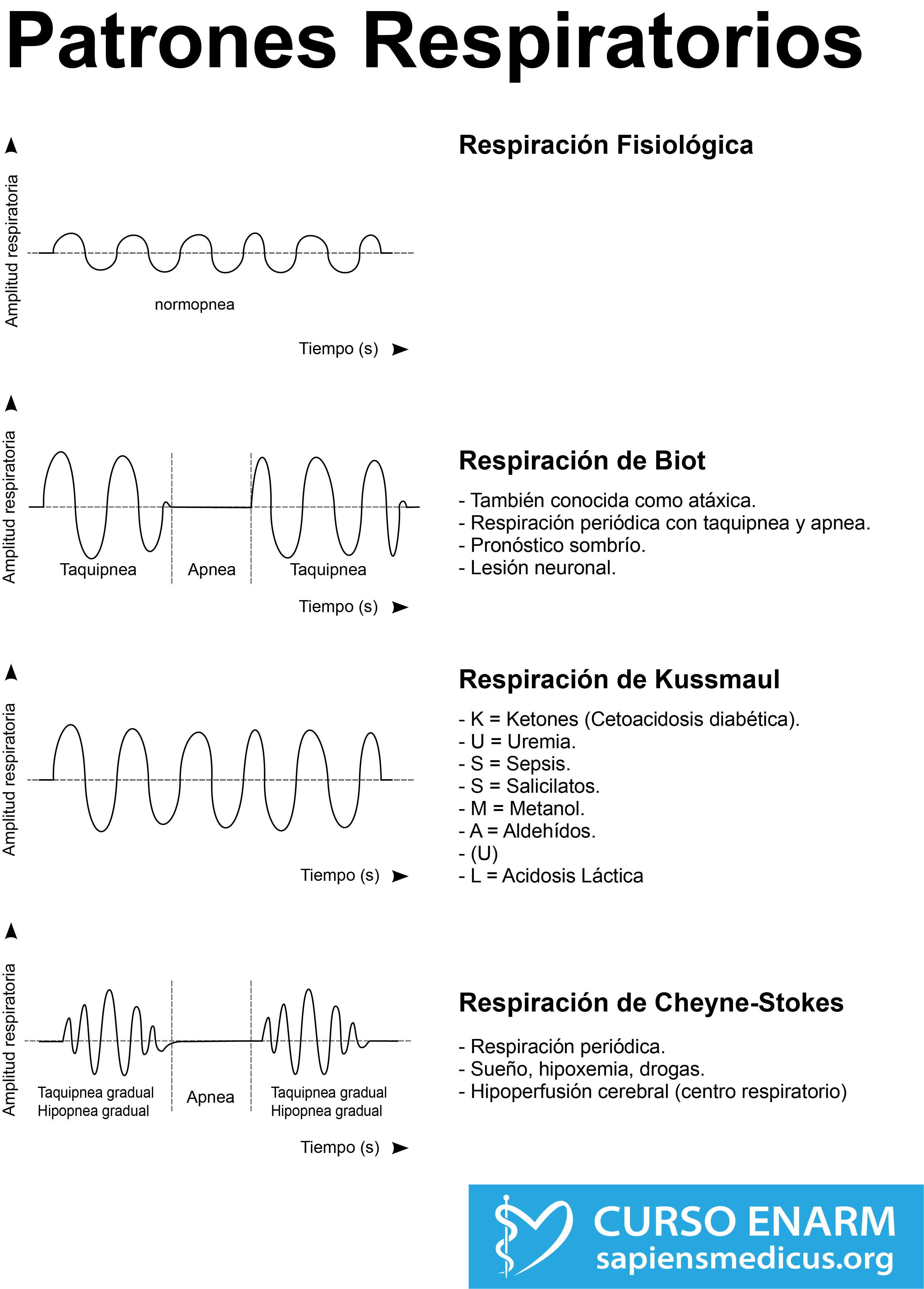 Respiración Atáxica