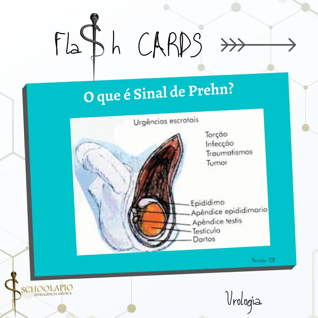 Anatomia Do Apendice Testicular Classic Case Reproduction Leik