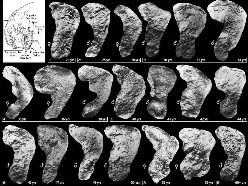 Auricular Surface Age