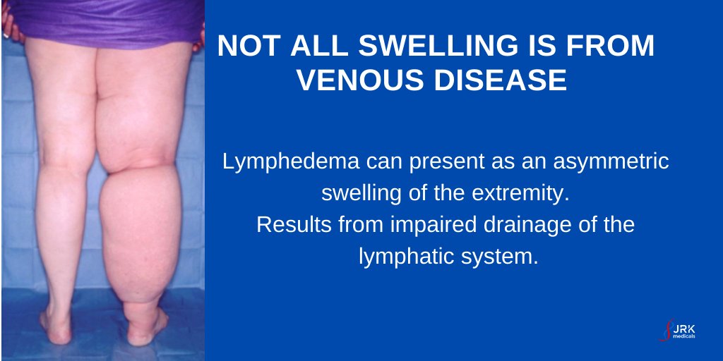 Massage For Lymphedema In Leg