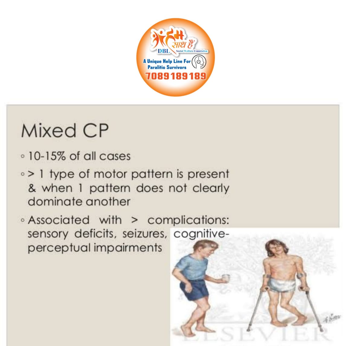 Mixed Cerebral Palsy