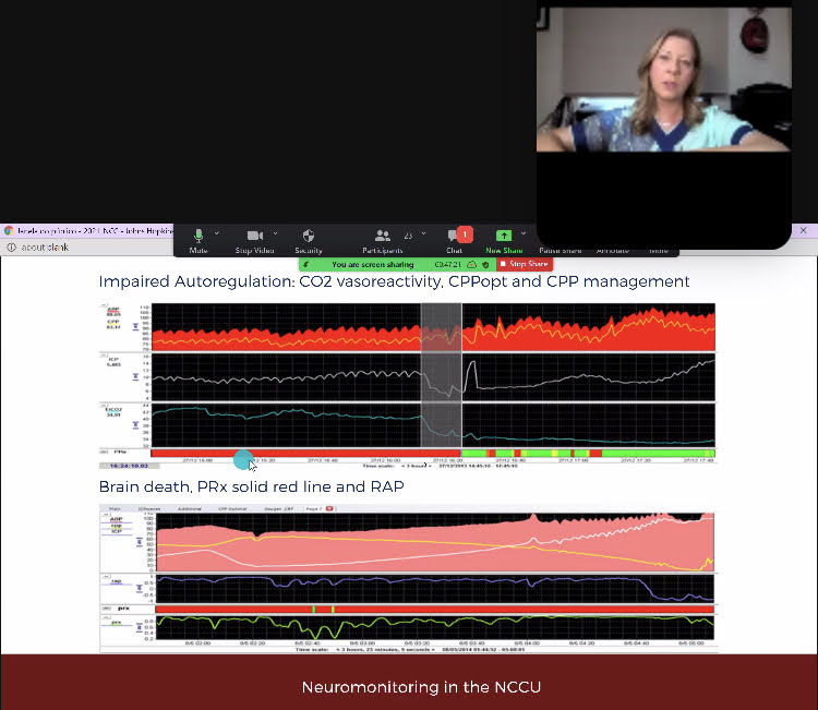 Neuroanesthesia – Johns Hopkins Anesthesiology & Critical Care Medicine