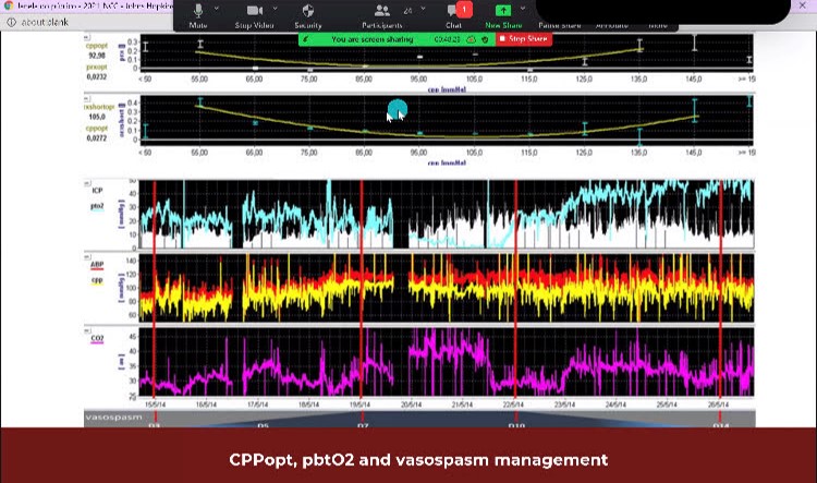 Neuroanesthesia – Johns Hopkins Anesthesiology & Critical Care Medicine